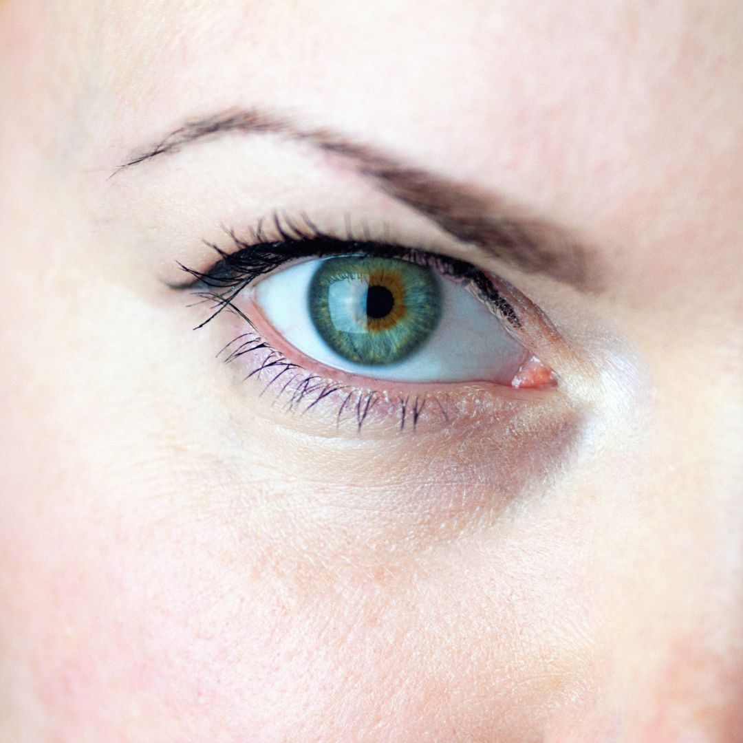 Brow Lifts: Enhance Eye Appearance & Facial Balance